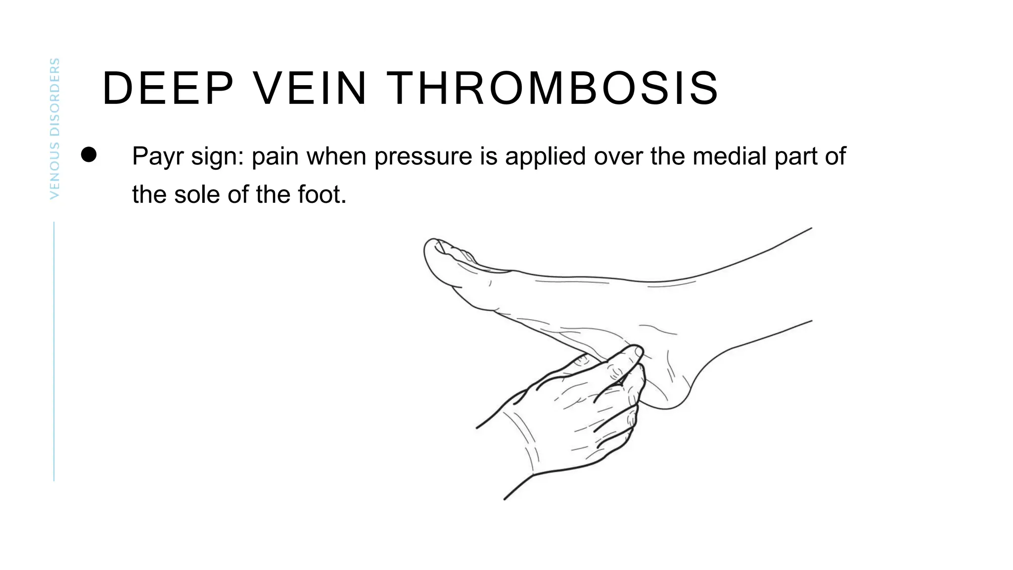 Venous disorders of the lower limbs, general surgery | PPTX