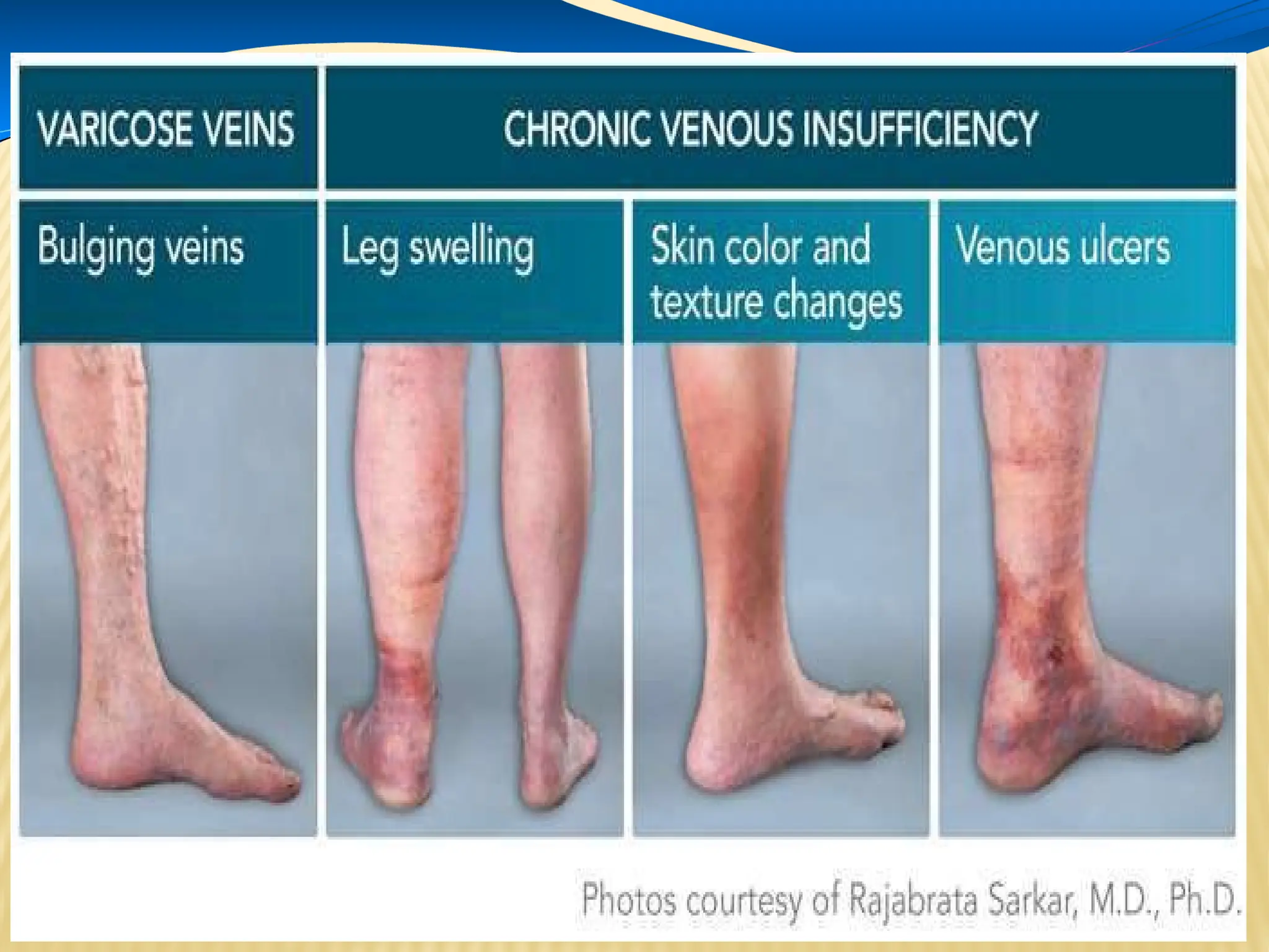 venous doppler lower limb arterial and venous | PPTX