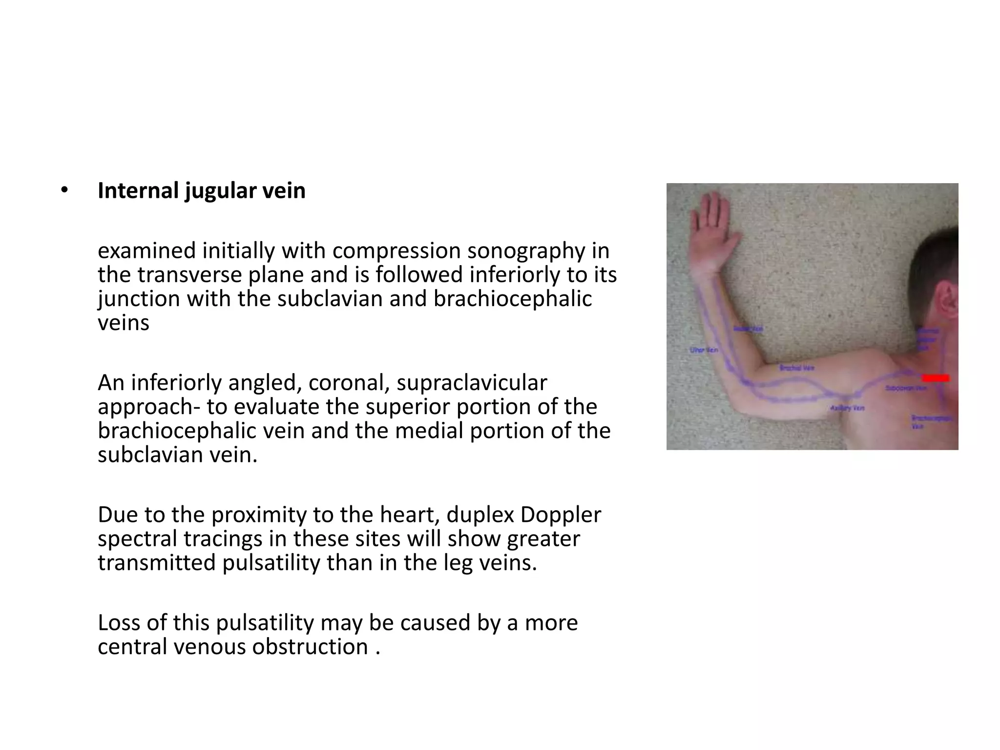 Venous Doppler upper limb | PPTX