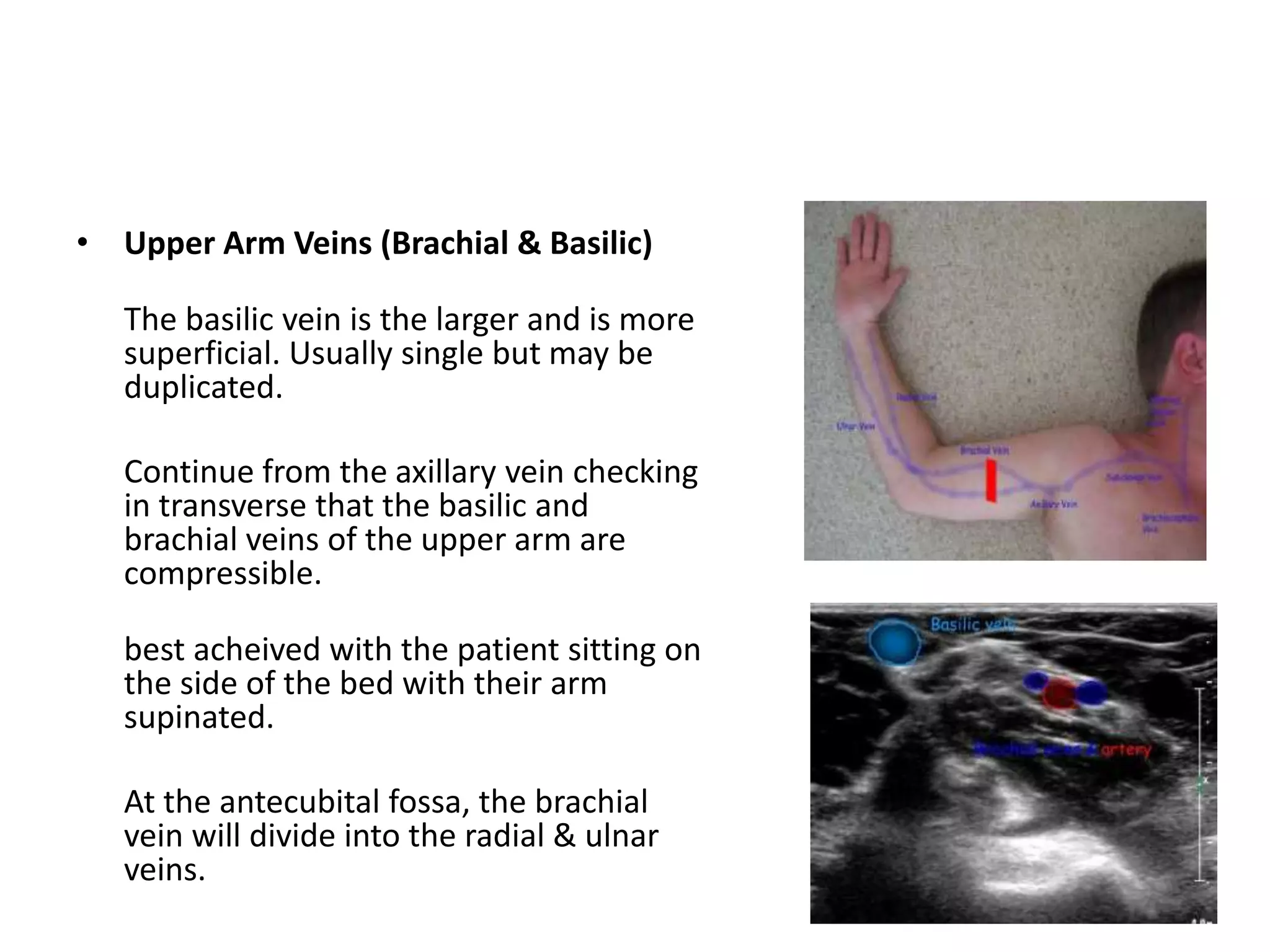 Venous Doppler upper limb | PPTX