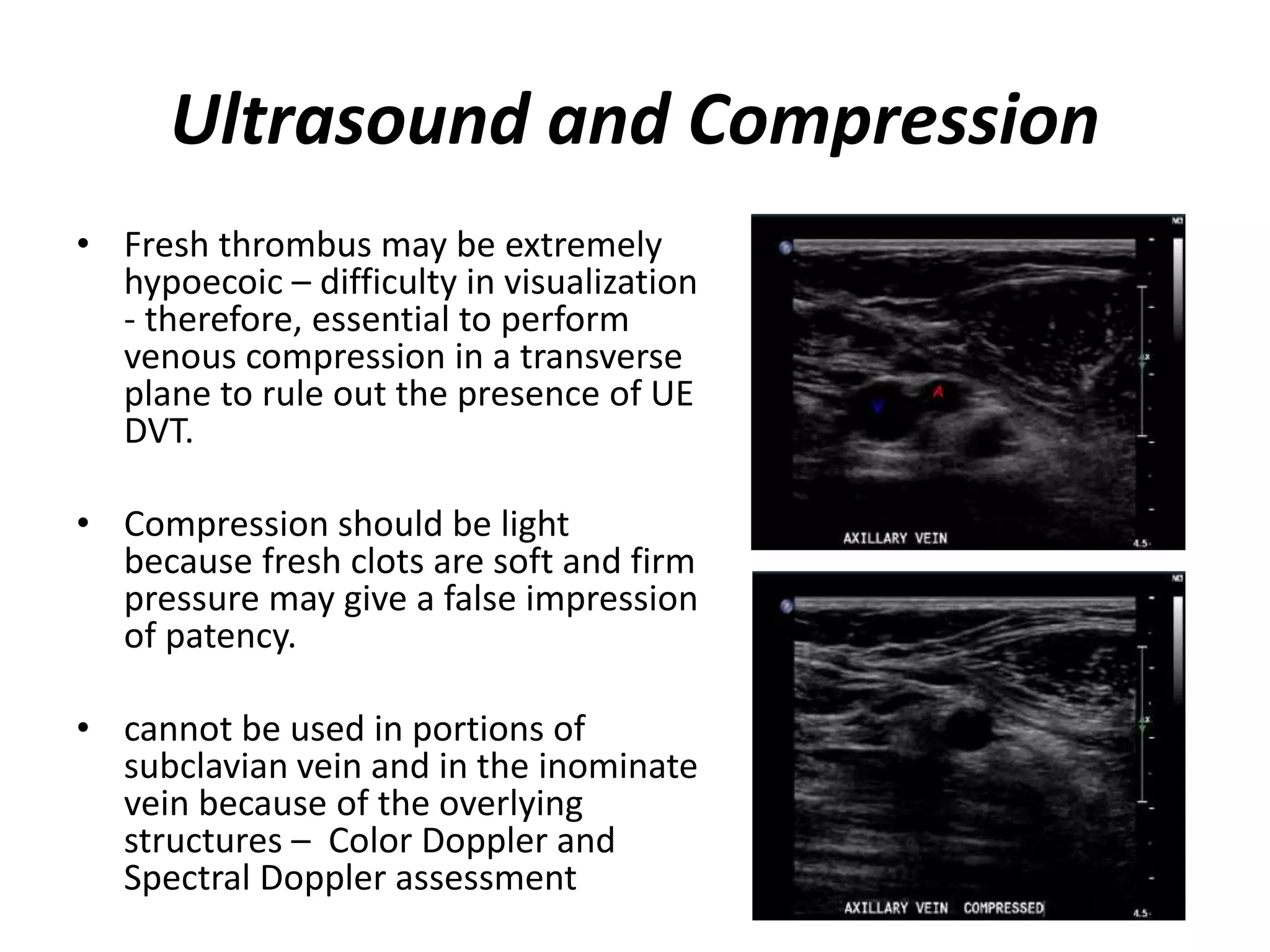 Venous Doppler upper limb | PPTX