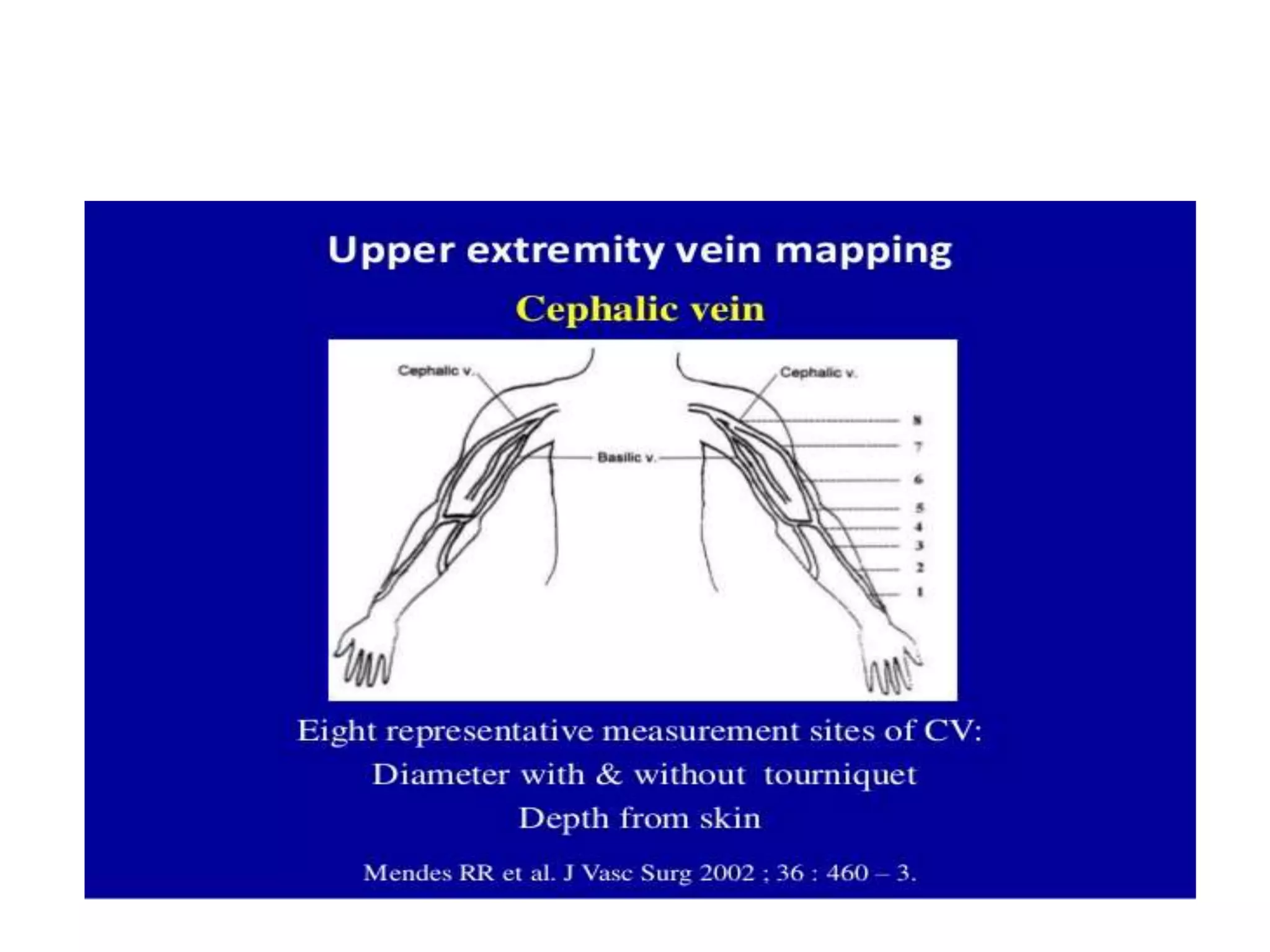 Venous Doppler upper limb | PPTX