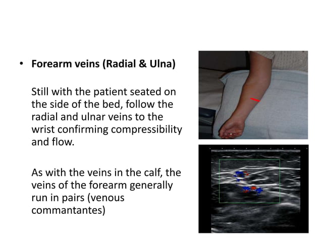 Venous Doppler upper limb | PPTX
