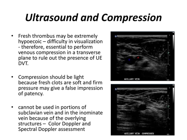 Venous Doppler upper limb | PPTX