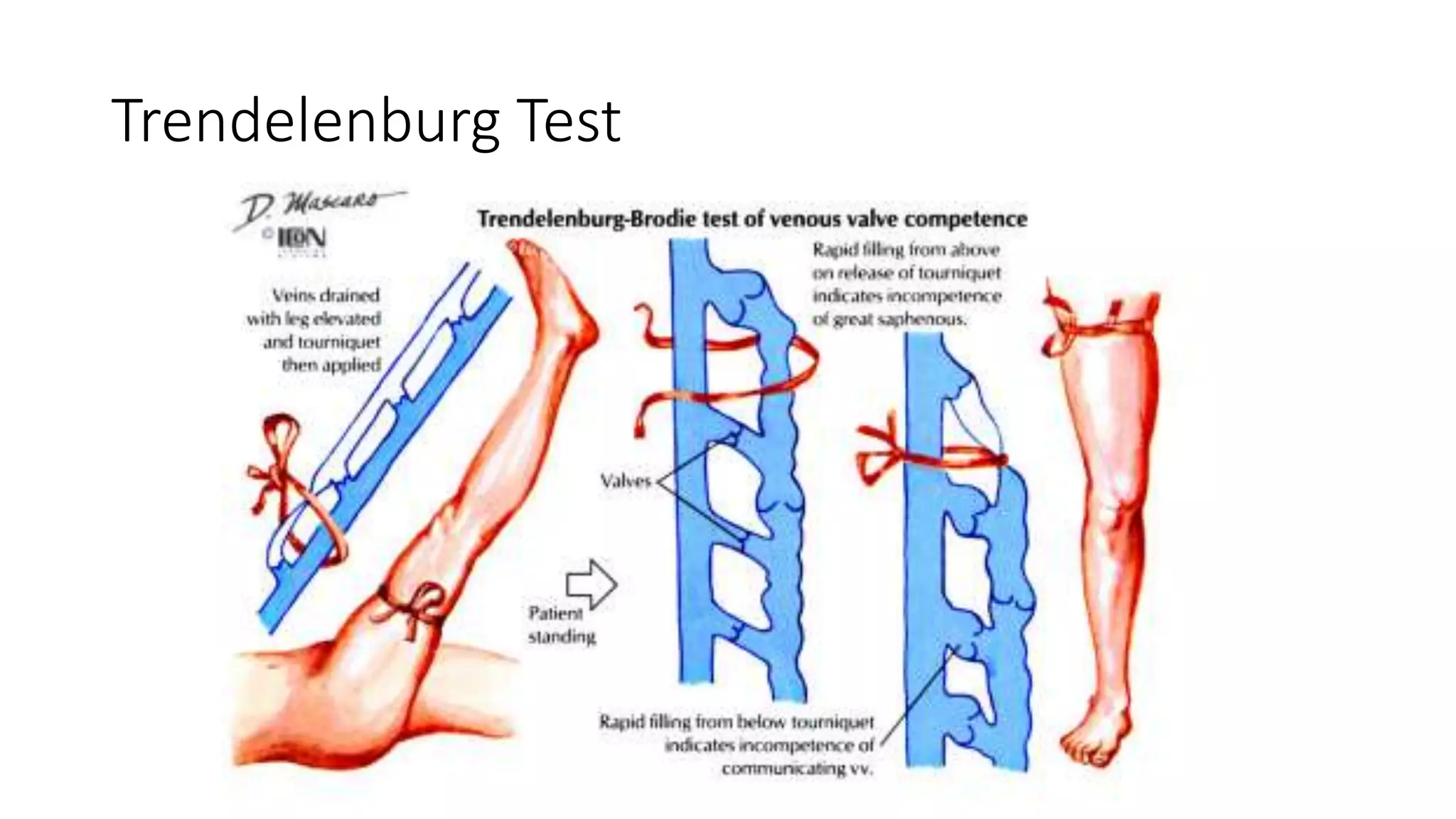 Venous drainage | PPTX