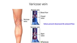 Venous drainage | PPTX