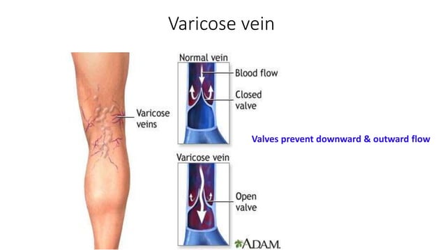 Venous drainage | PPTX | Heart and Cardiovascular Diseases | Diseases ...