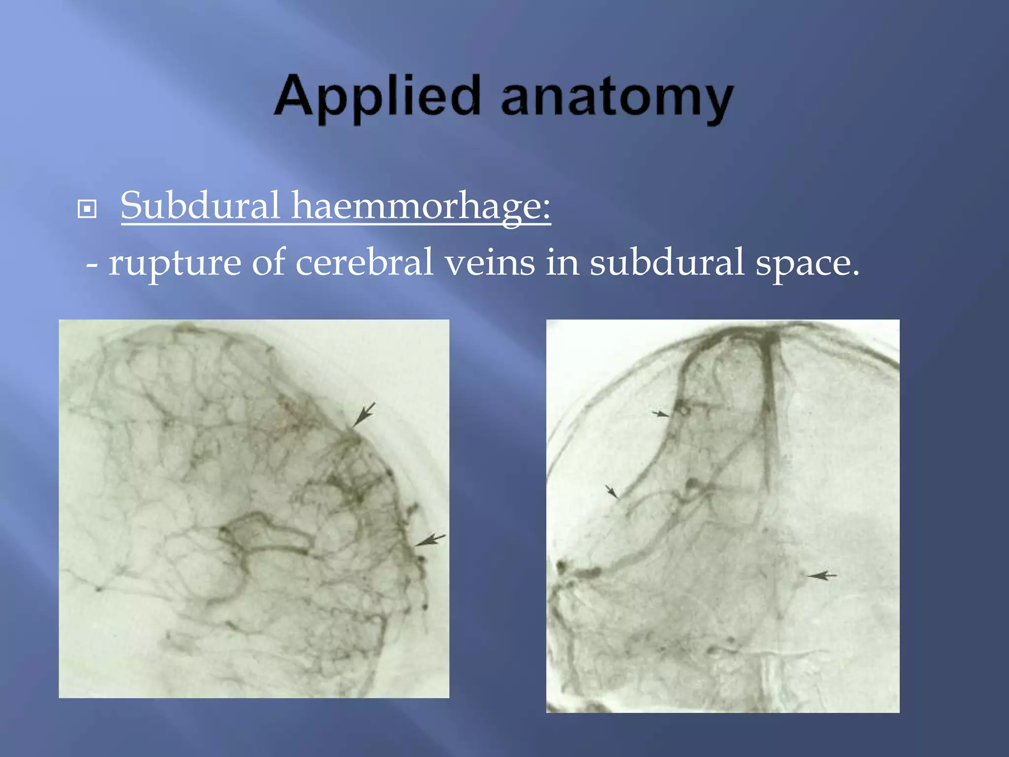 Venous drainage of brain | PPTX