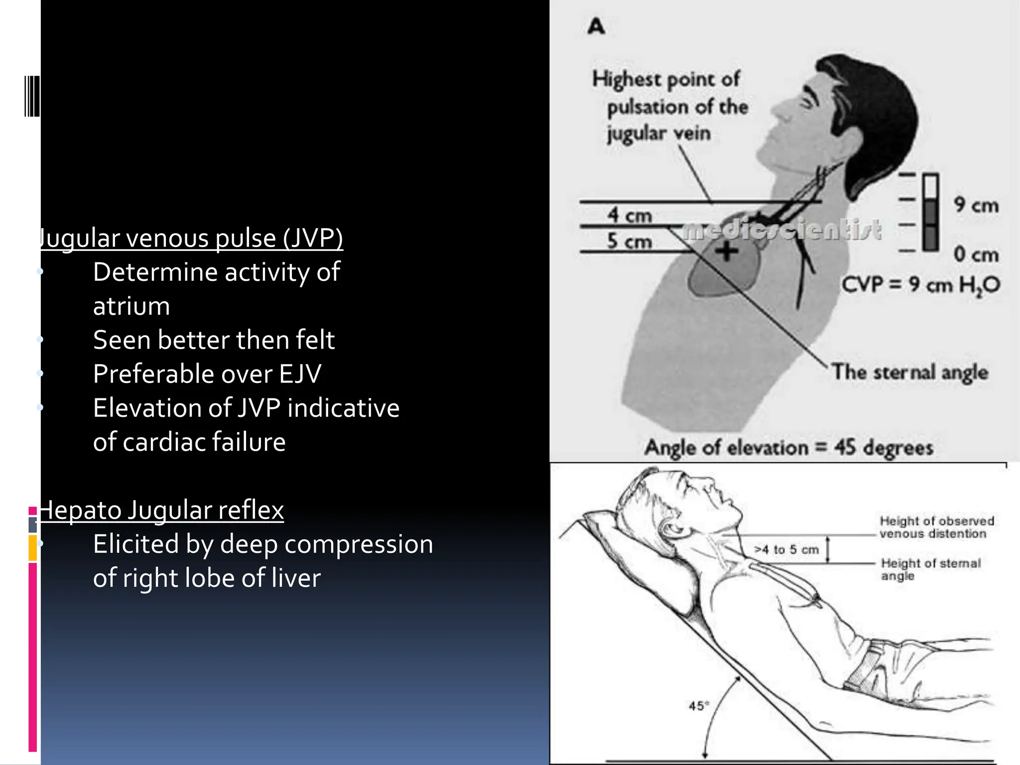 VENOUS DRAINAGE OF FACE.pptx