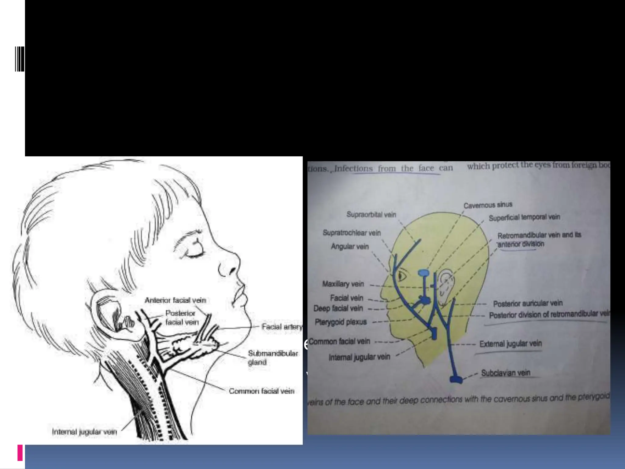 VENOUS DRAINAGE OF FACE.pptx