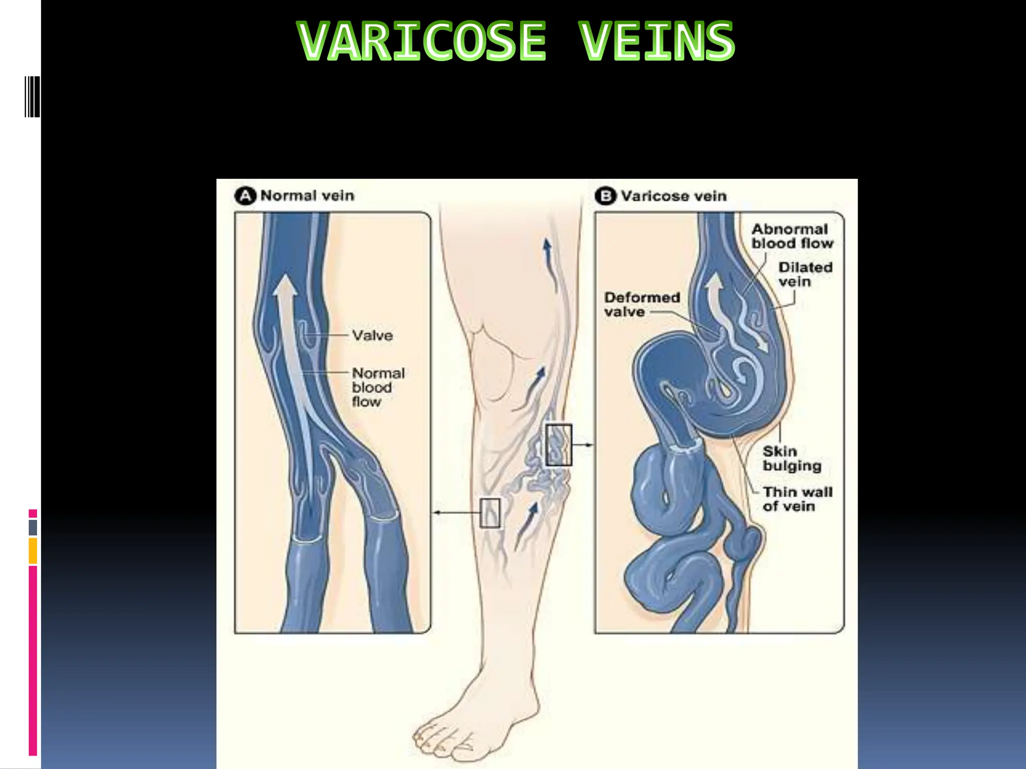 VENOUS DRAINAGE OF FACE.pptx
