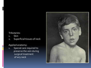 VENOUS DRAINAGE OF FACE.pptx