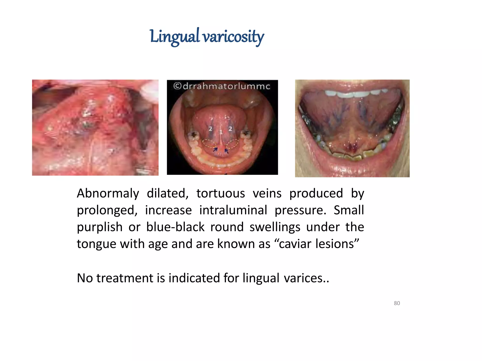 VENOUS DRAINAGE OF HEAD, FACE, NECK AND BRAIN | PPTX