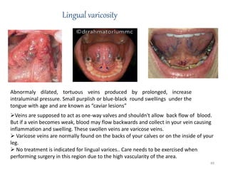 Venous drainage of head and neck | PPTX