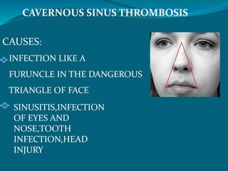 Venous drainageof head and neck ih | PPTX