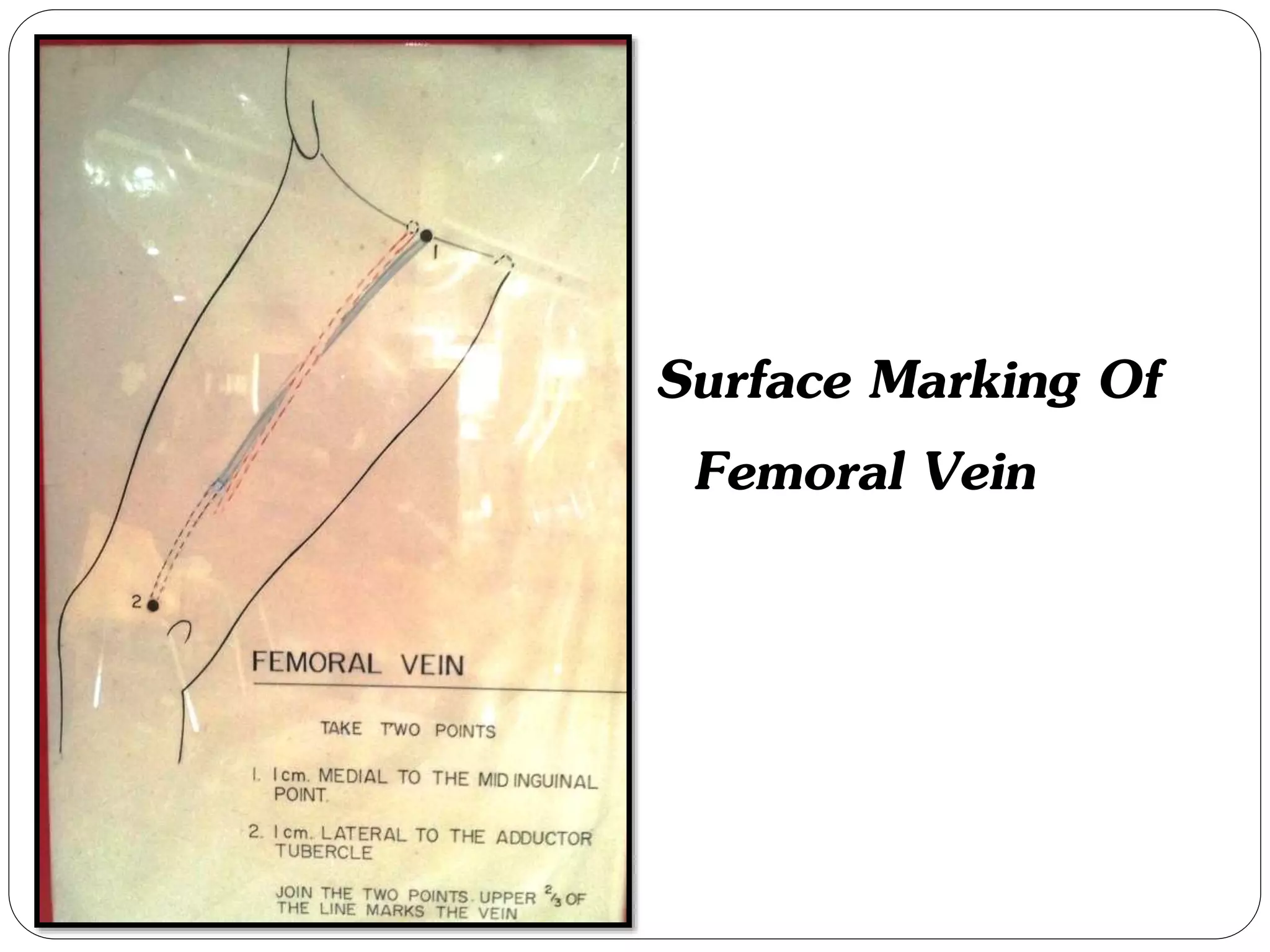 Venous drainage of lower limb | PPTX