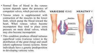 Venous drainage of lower limb.pptx for med students | PPTX