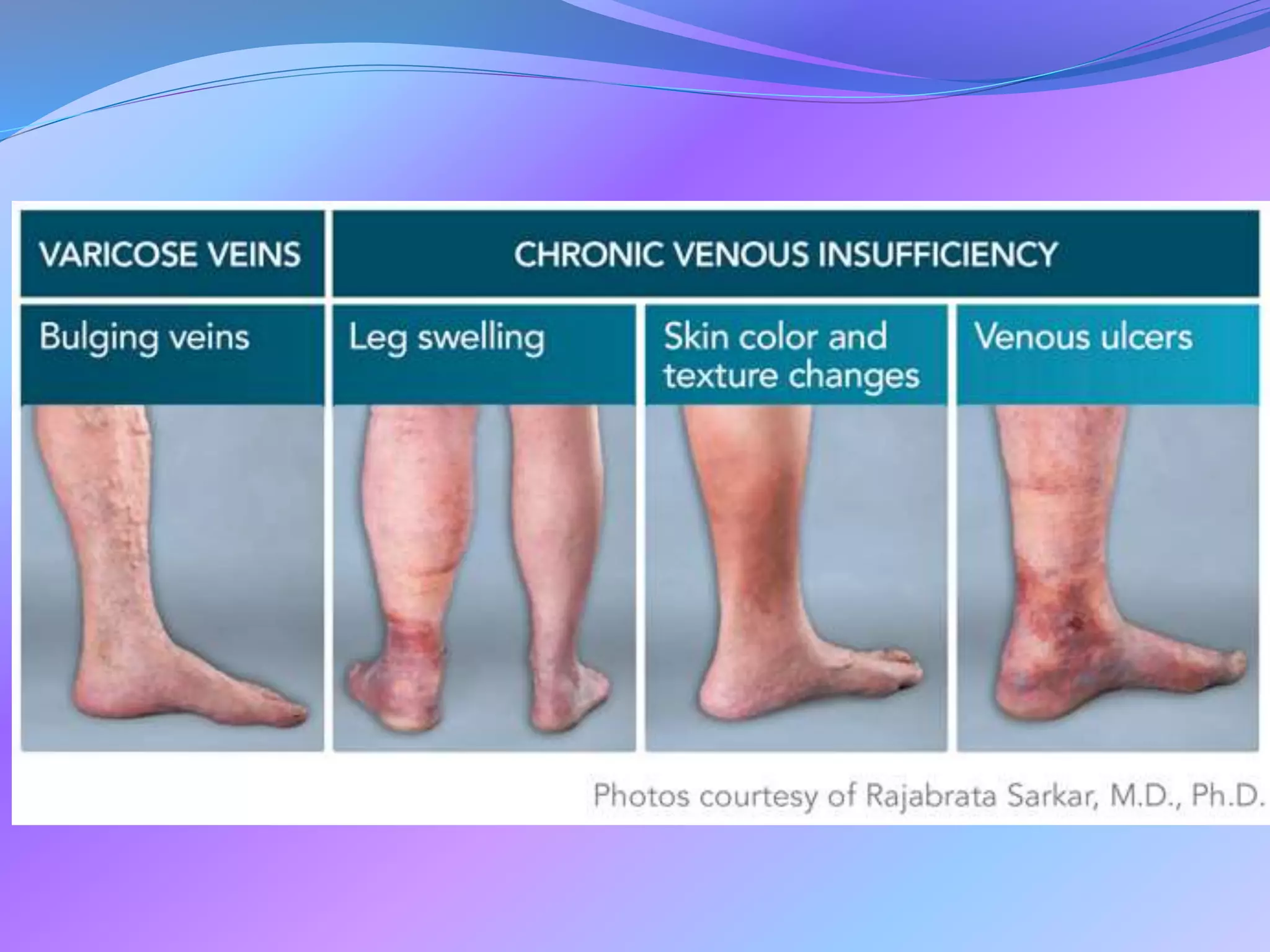 Venous drainage of lower limb ppt | PPTX