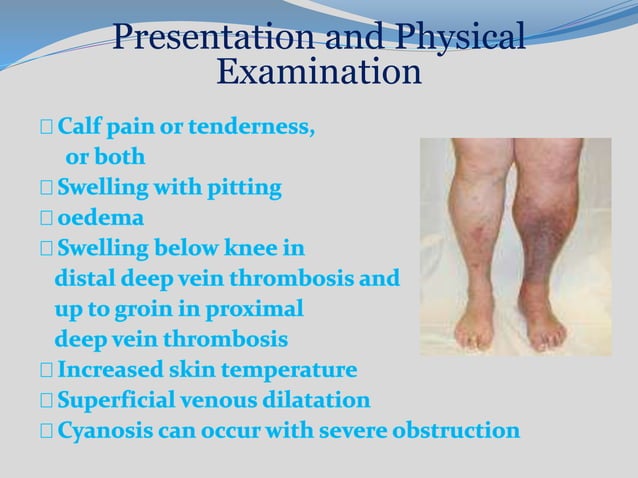 Venous drainage of lower limb ppt | PPTX