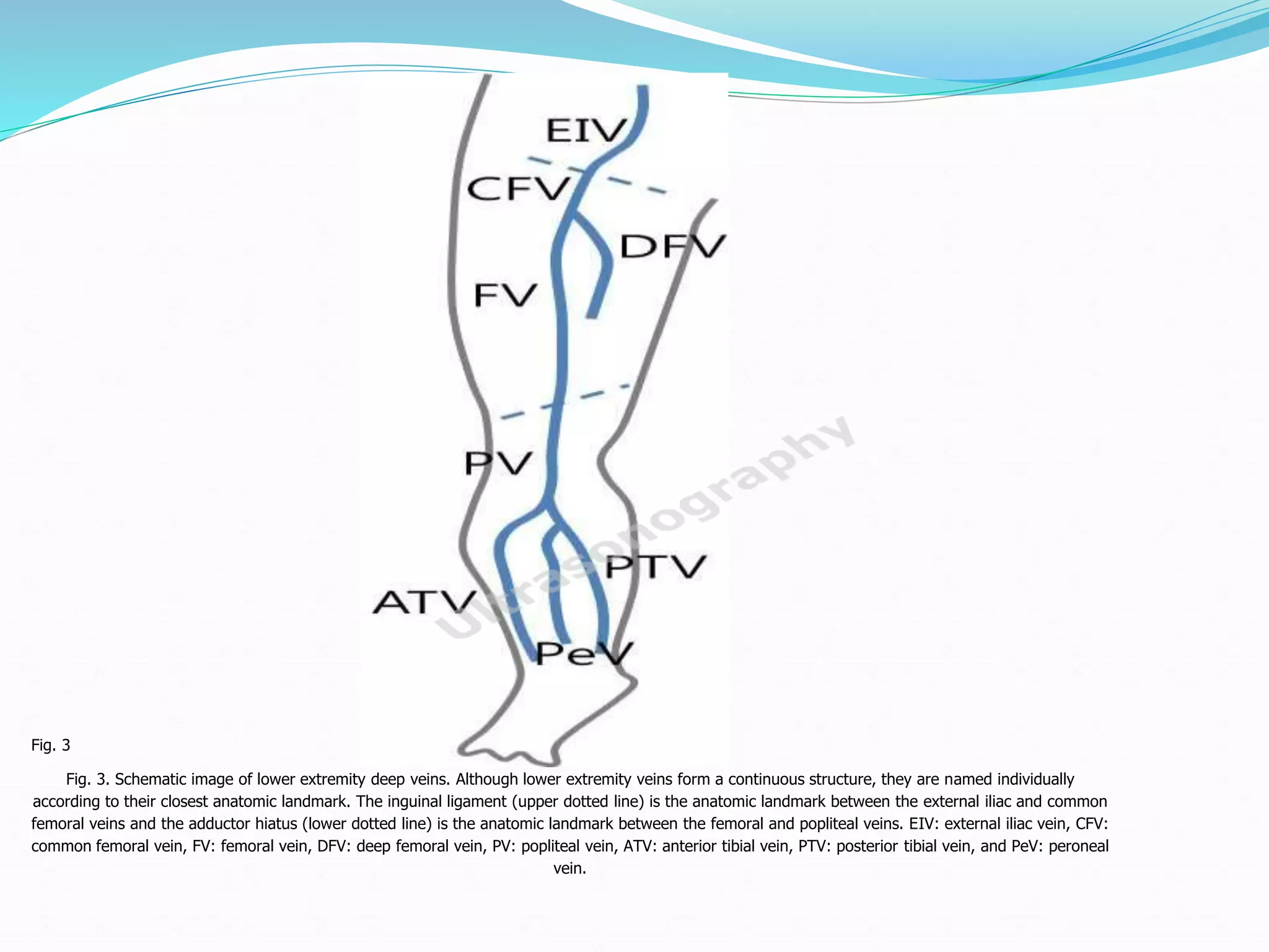 VENOUS DRAINAGE OF THE LOWER LIMBS.ppt