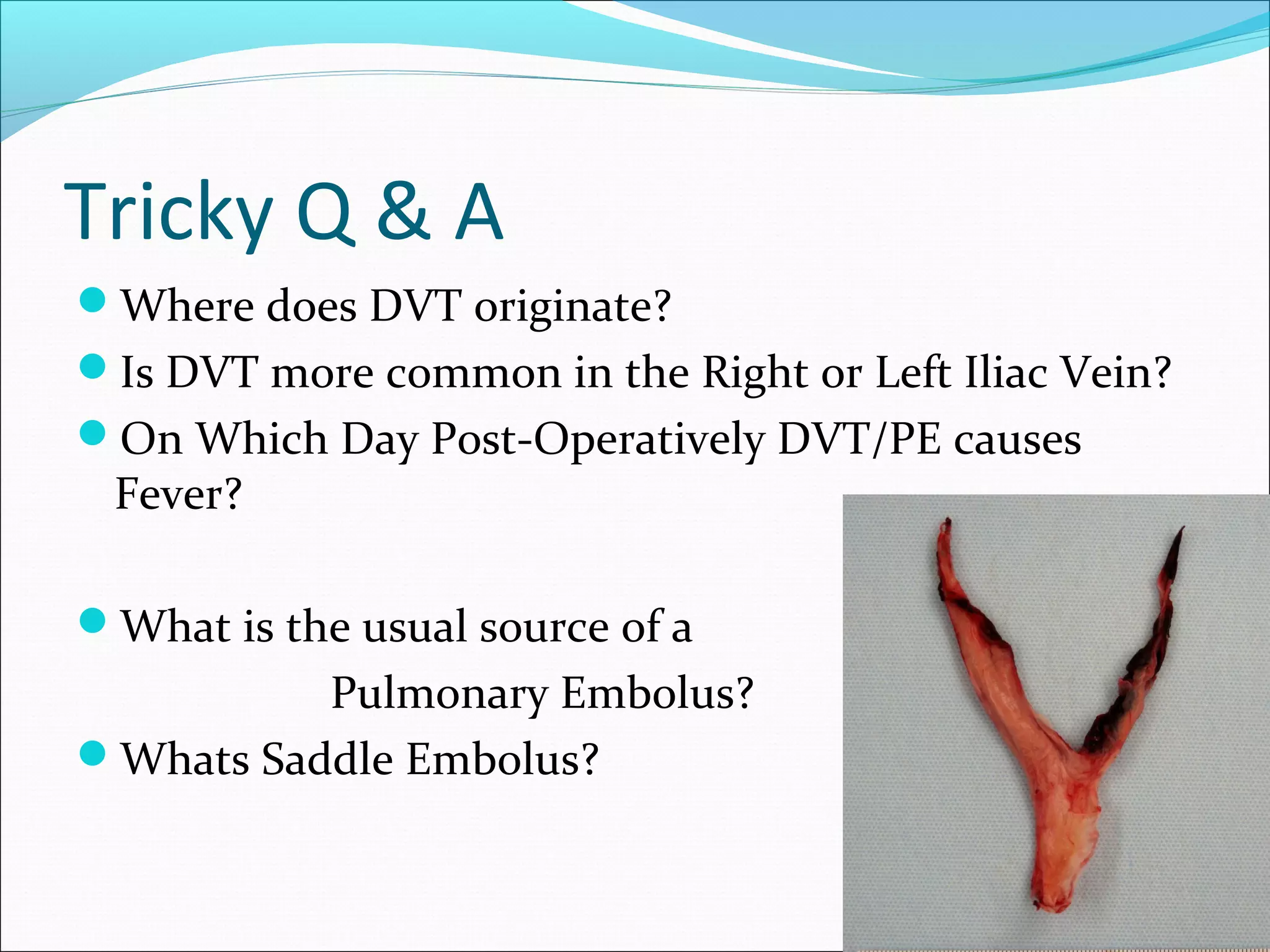 Venous insufficiency dvt - final year mbbs lecture | PPT