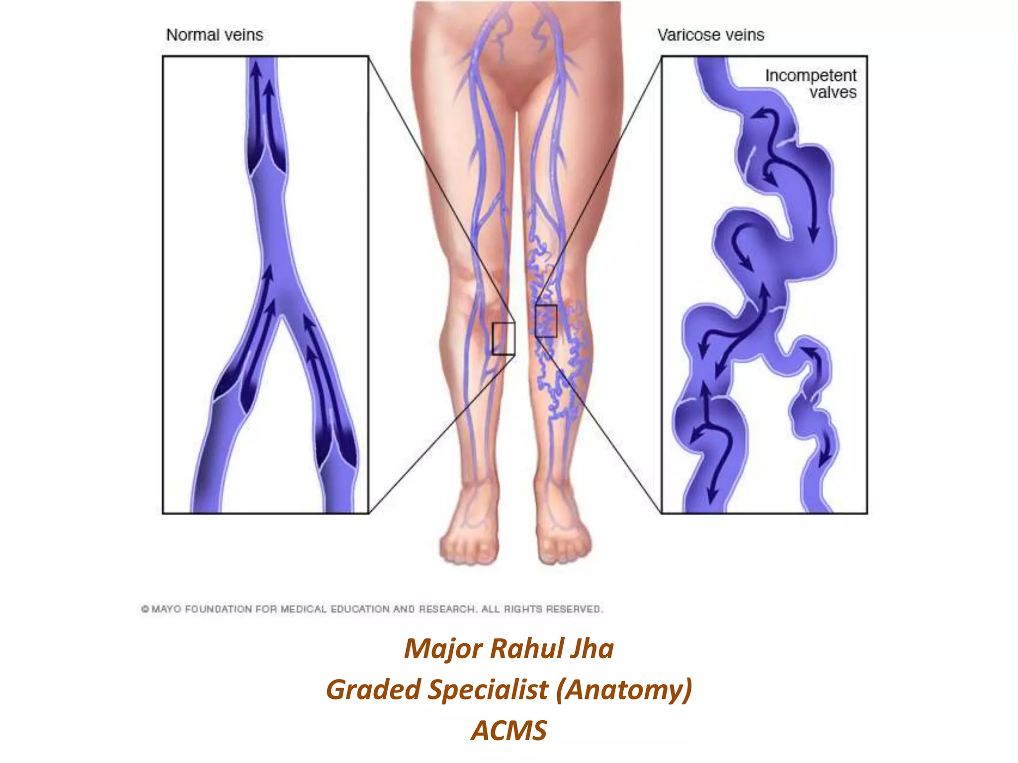 Venous lymphatic drainage of lower limb | PPTX