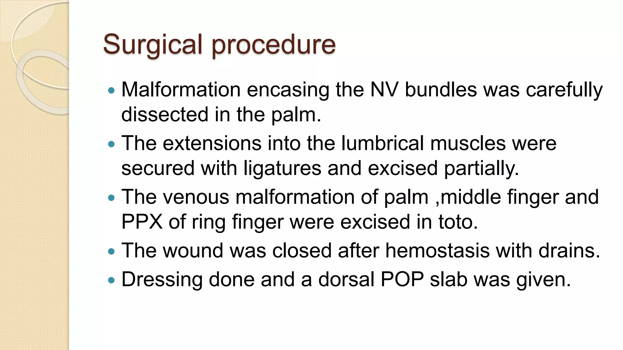 Venous malformation hand | PPTX