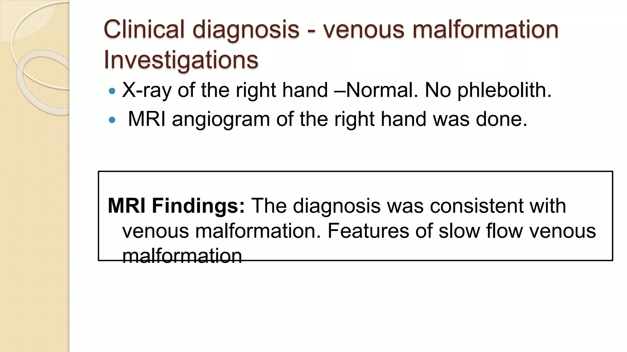 Venous malformation hand | PPTX