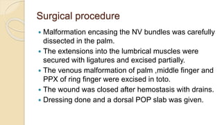 Venous malformation hand | PPT