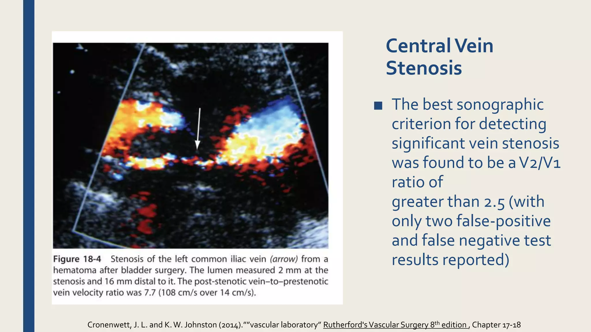 Venous physiology assessment | PPTX