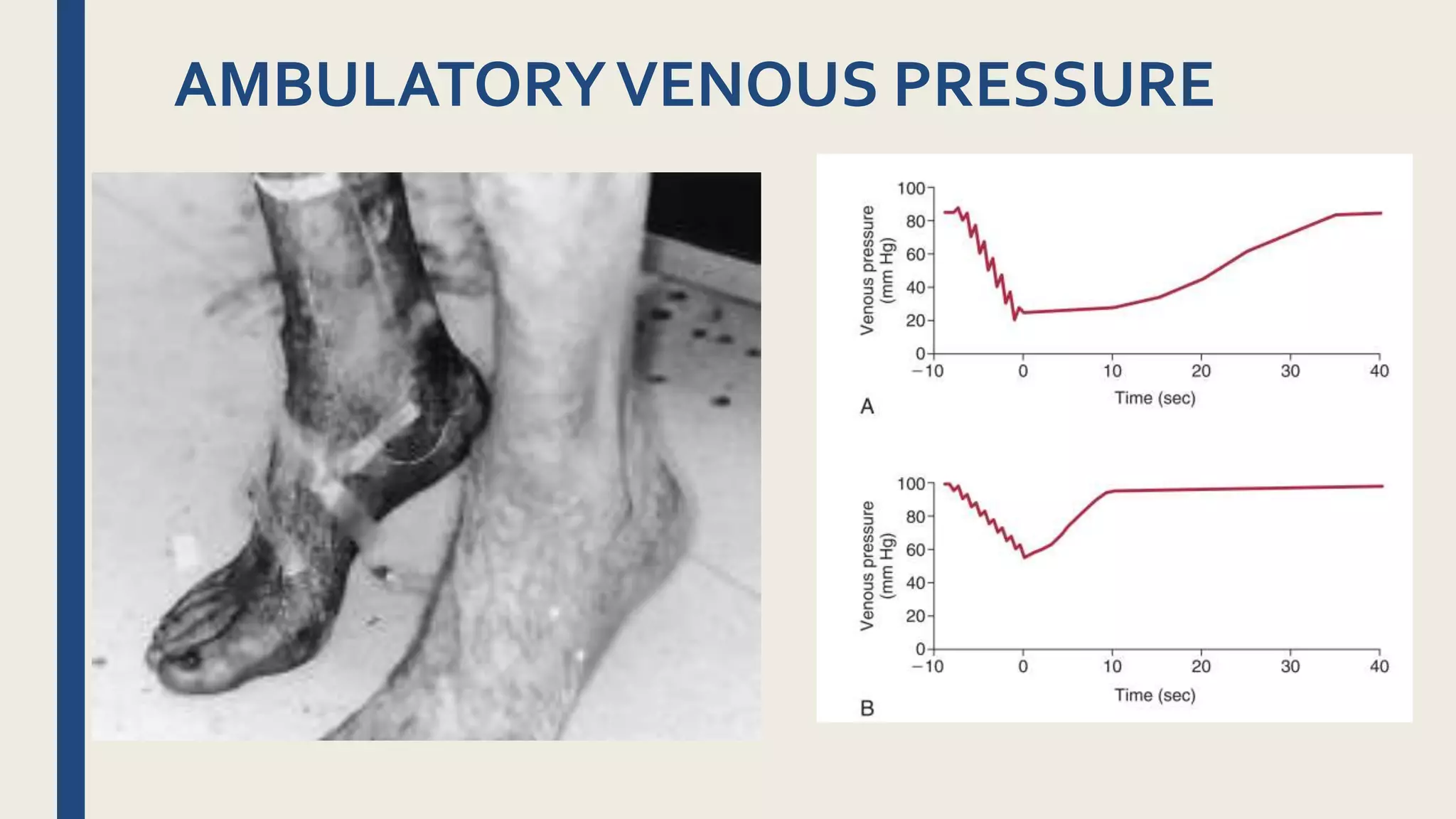 Venous physiology assessment | PPTX