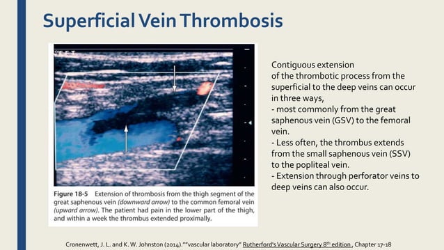 Venous physiology assessment | PPTX
