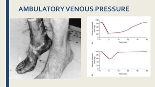 Venous physiology assessment | PPT