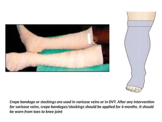Venous system examination in surgery.pptx
