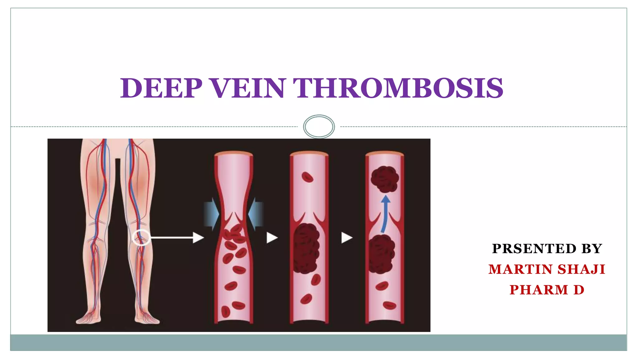 Venous thrombo embolism / deep vein thrombosis | PPTX | Blood Disorders ...