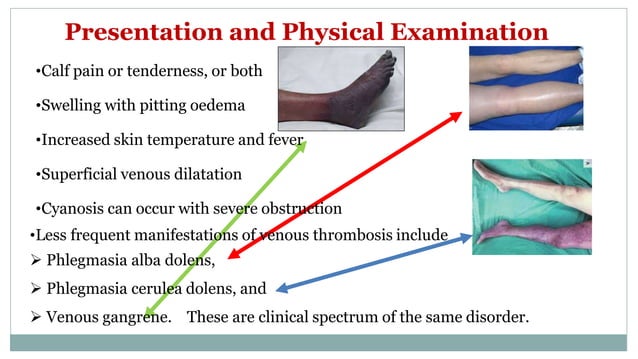 Venous thrombo embolism / deep vein thrombosis | PPTX | Blood Disorders ...