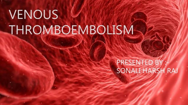 Venous thromboembolism | PPTX