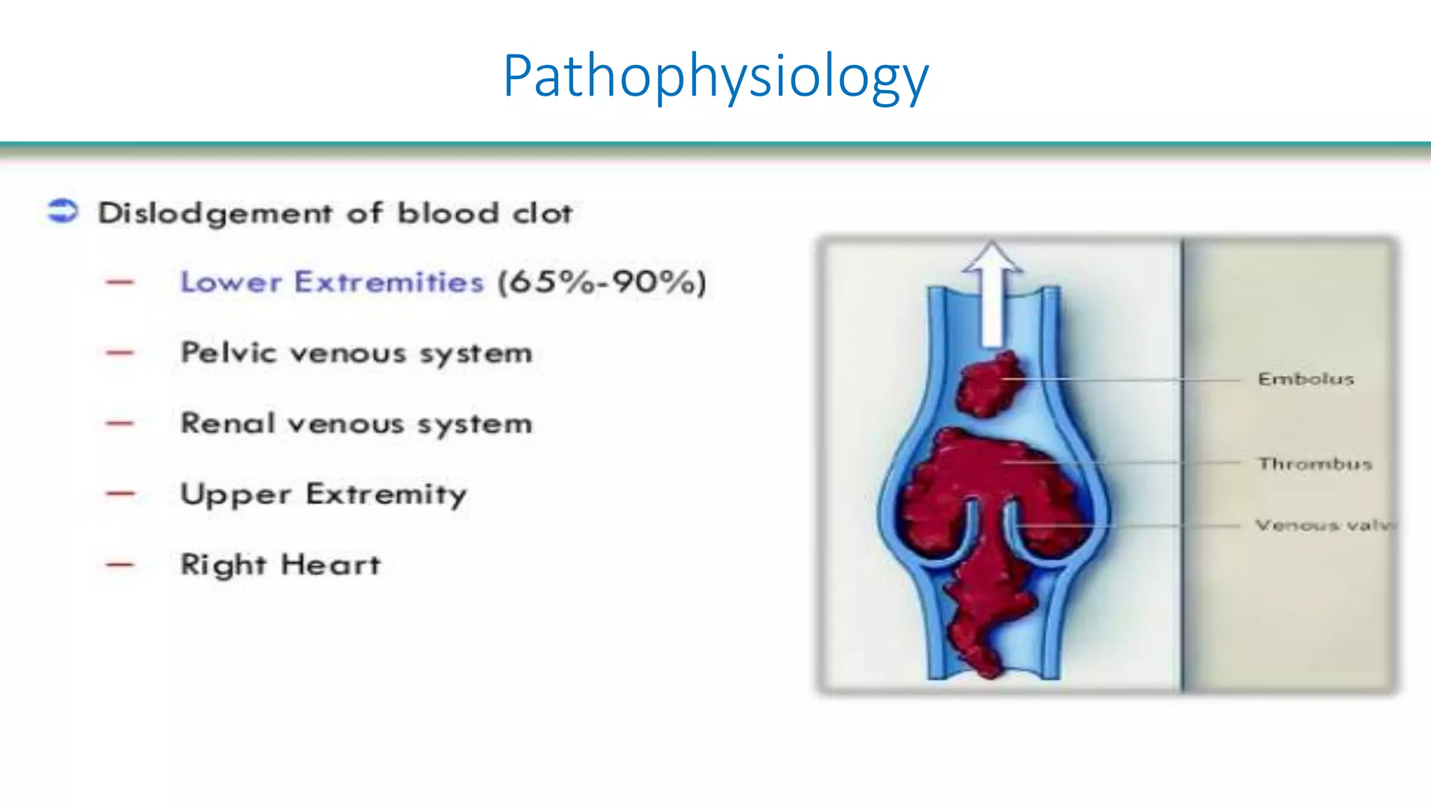 Venous thromboembolism | PPT