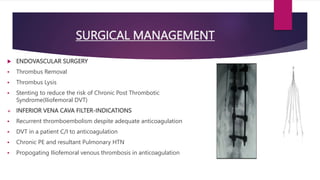 VENOUS THROMBOEMBOLISM (VTE) PRESENTATION.pptx