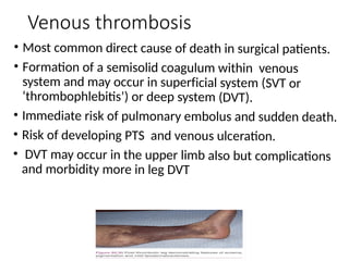 Deep venous thrombosis of upper and lower limb.ppt