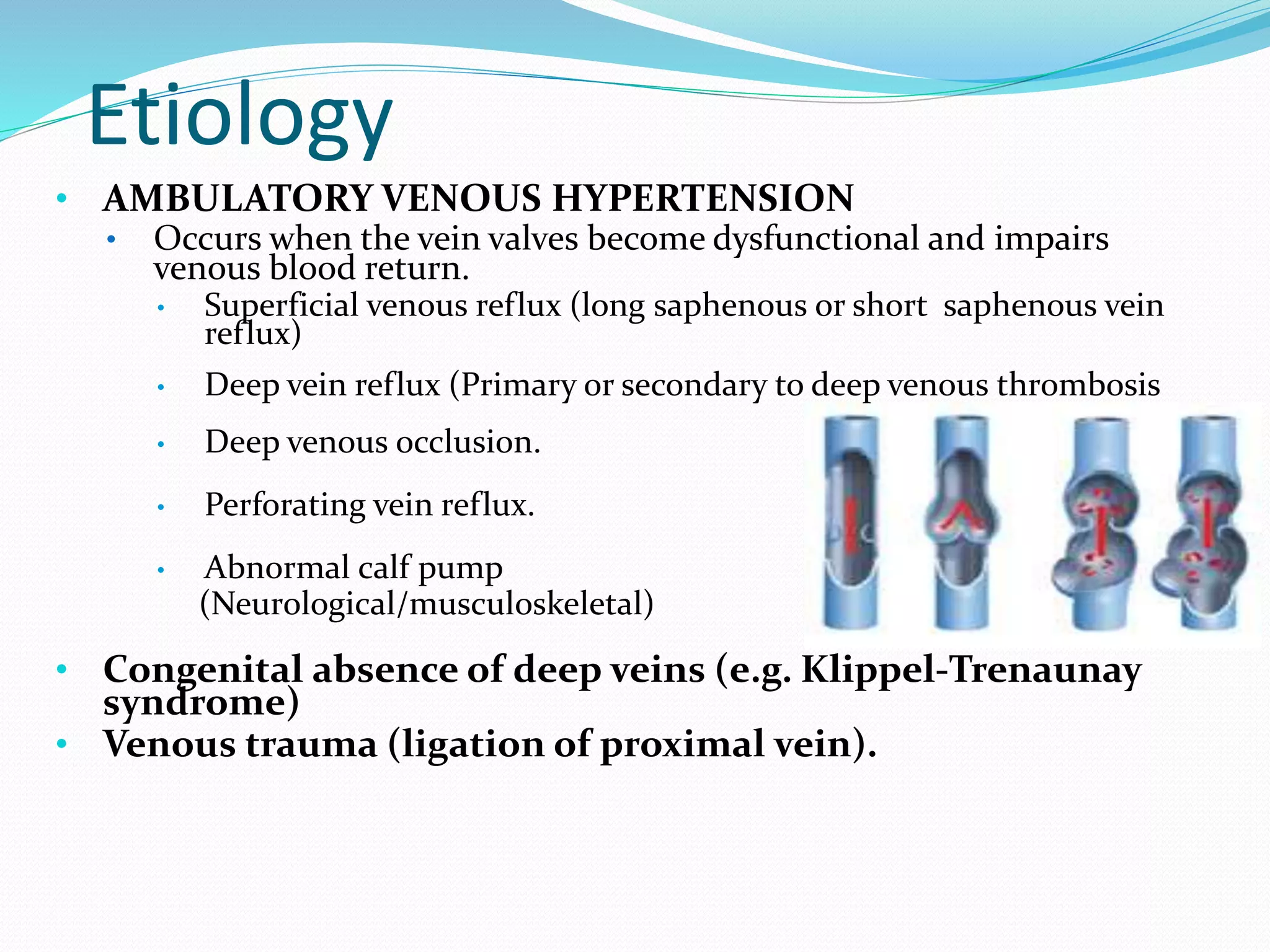 Venous ulceers | PPTX
