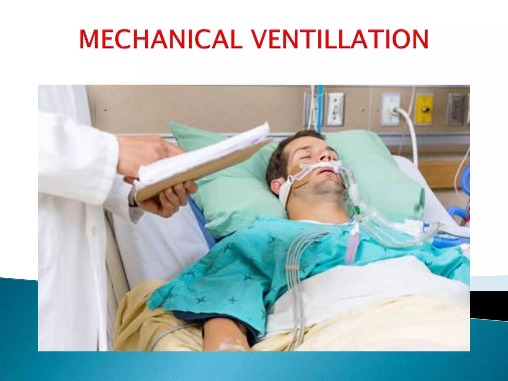 Vent and Tracheostomy | PPTX