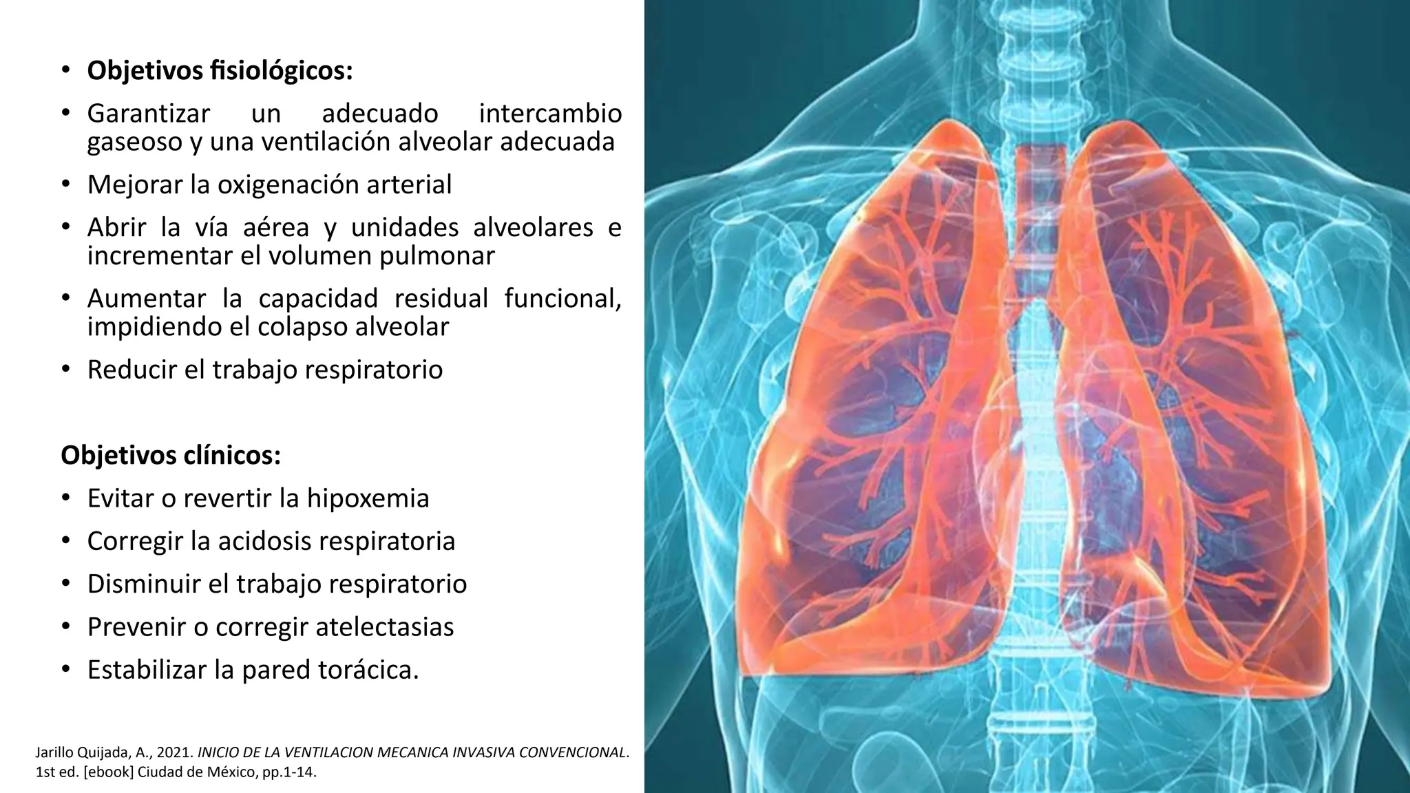 ventilacion.pptx5615616515615616516515615615 | PPTX | Lung and ...