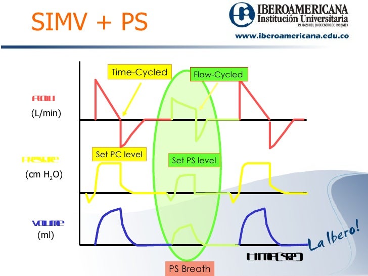 Ventilacion mecanica