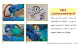 Ventilacion por presion positiva | PPTX