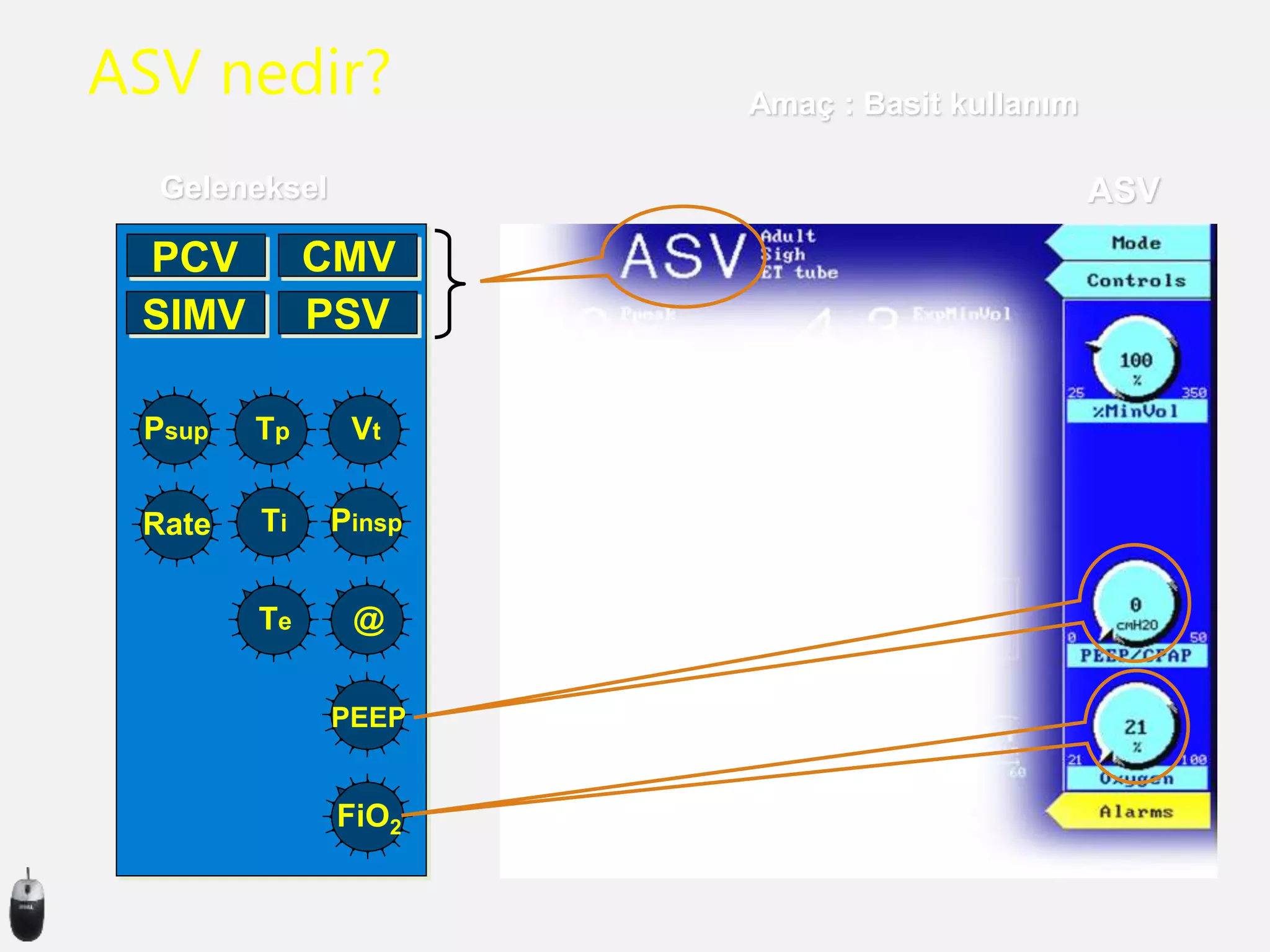 ventilasyon-mod.ppt