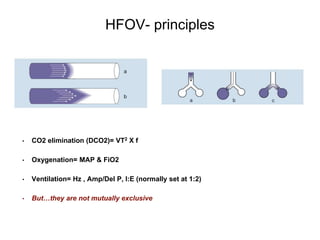 Ventilation | PPTX | Lung and Respiratory Health | Diseases and Conditions