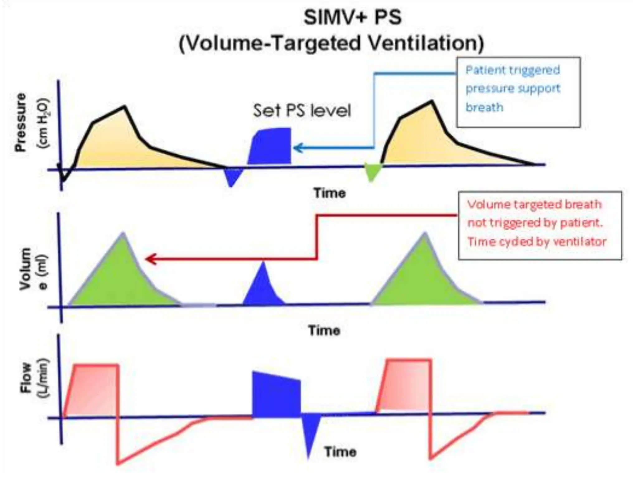 Ventilation types of modes of ventilation.ppt
