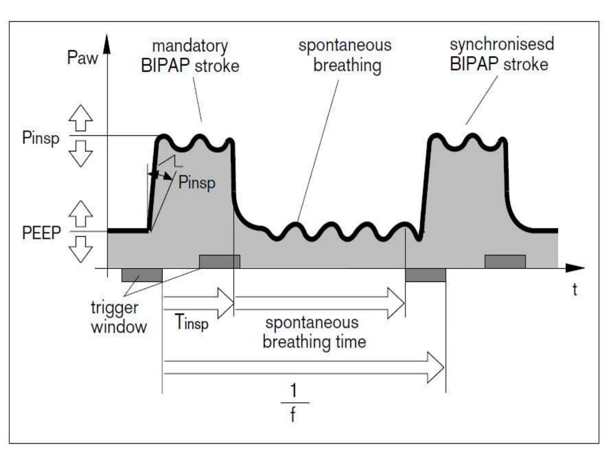 Ventilation types of modes of ventilation.ppt