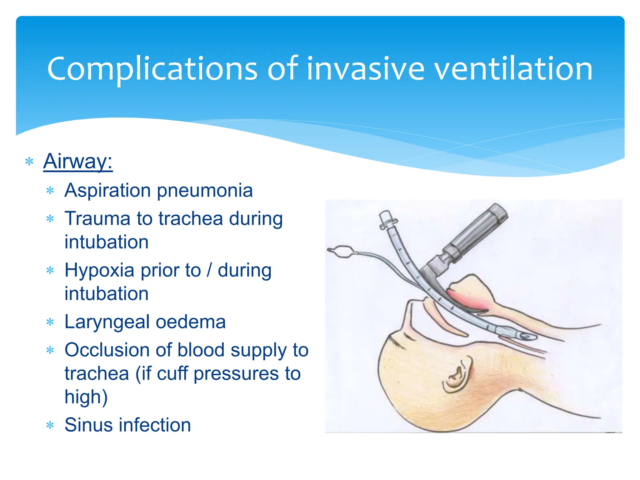 Ventilation types of modes of ventilation.ppt